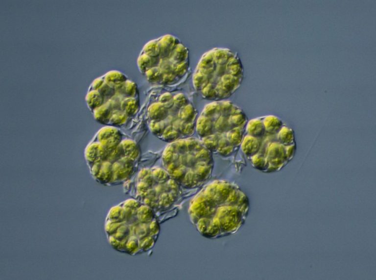 » Coelastrum reticulatum - BeWie's Mikrowelt (single)