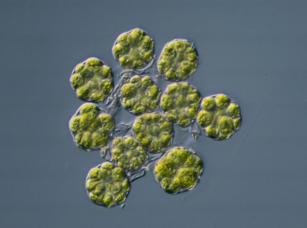 » Coelastrum reticulatum - BeWie's Mikrowelt (single)